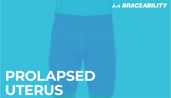 The #1 Guide to Pelvic Uterine Prolapse: What is a Prolapsed Uterus?